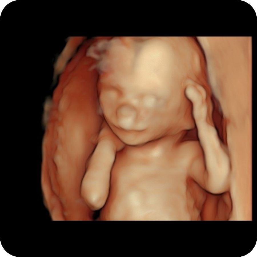 Gender + Wellbeing Scan | HerView Ultrasound – Herview Ultrasound